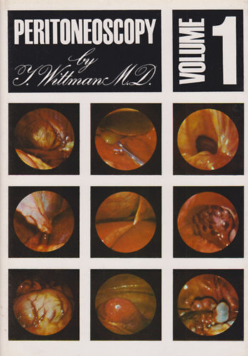 Libri Antikvár Könyv: Peritoneoscopy 1-2. - A laparoskopia atlasza 1-2 ...